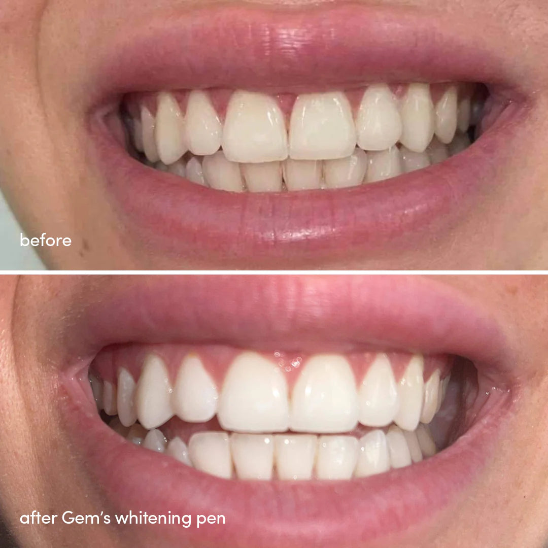 Gem Whitening Pen Coconut Mint – The Living Co.